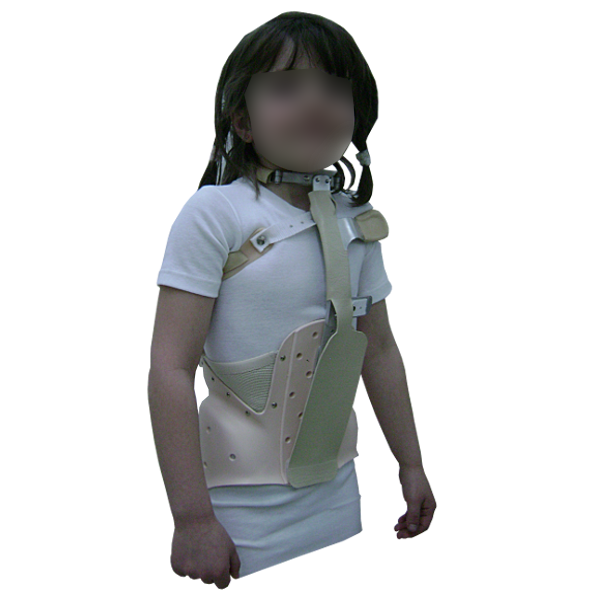 corset Milwaukee - Corsets de traitement scoliose - NEUT