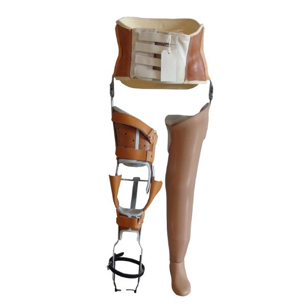 Prothèse fémorale avec orthèse cruro-pédieuse - Amputation fémorale - NEUT